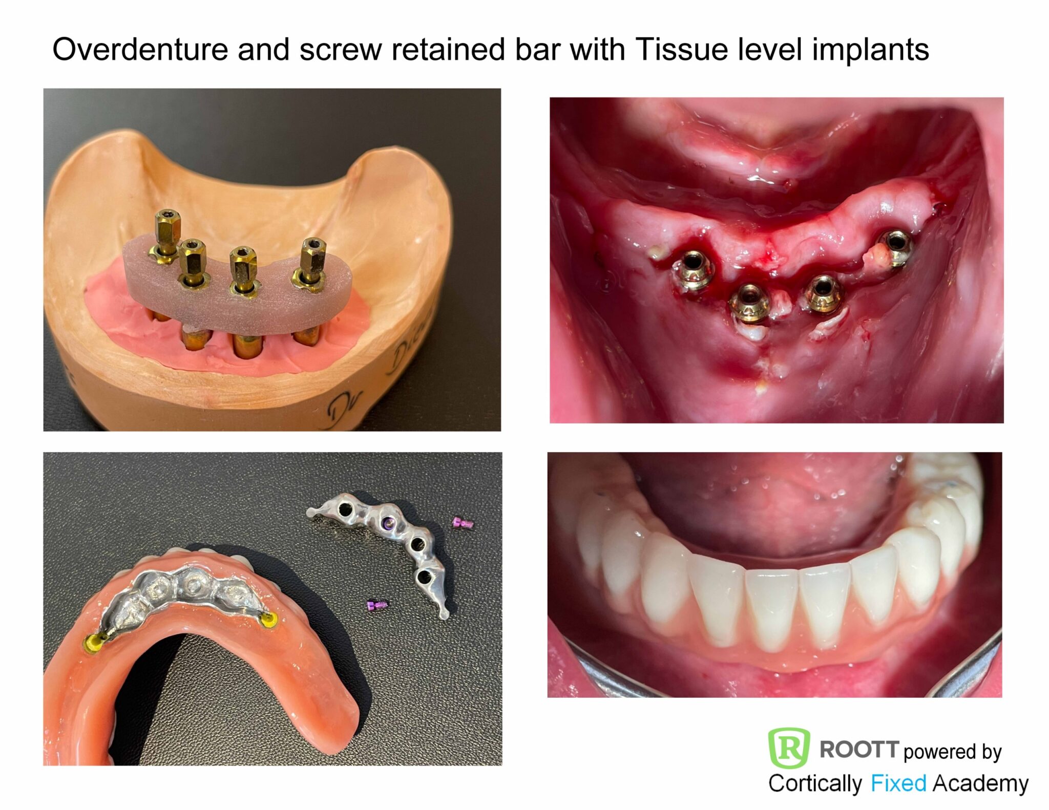 Patient Case Reports - Cortically Fixed Academy